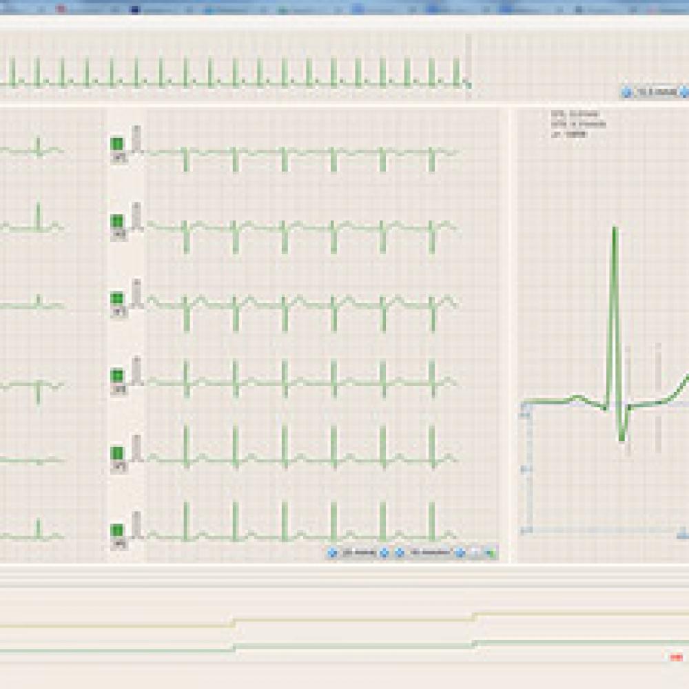 BTL CARDIOPOINT- ERGO E300 - Sorunuz + KDV