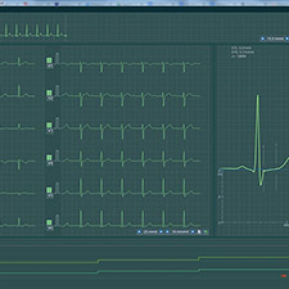 BTL CARDIOPOINT- ERGO E300 - Sorunuz + KDV